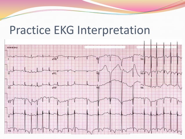 12 Lead EKG Interpretation