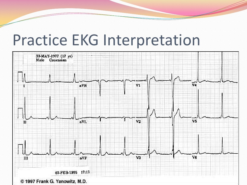12 Lead EKG Interpretation