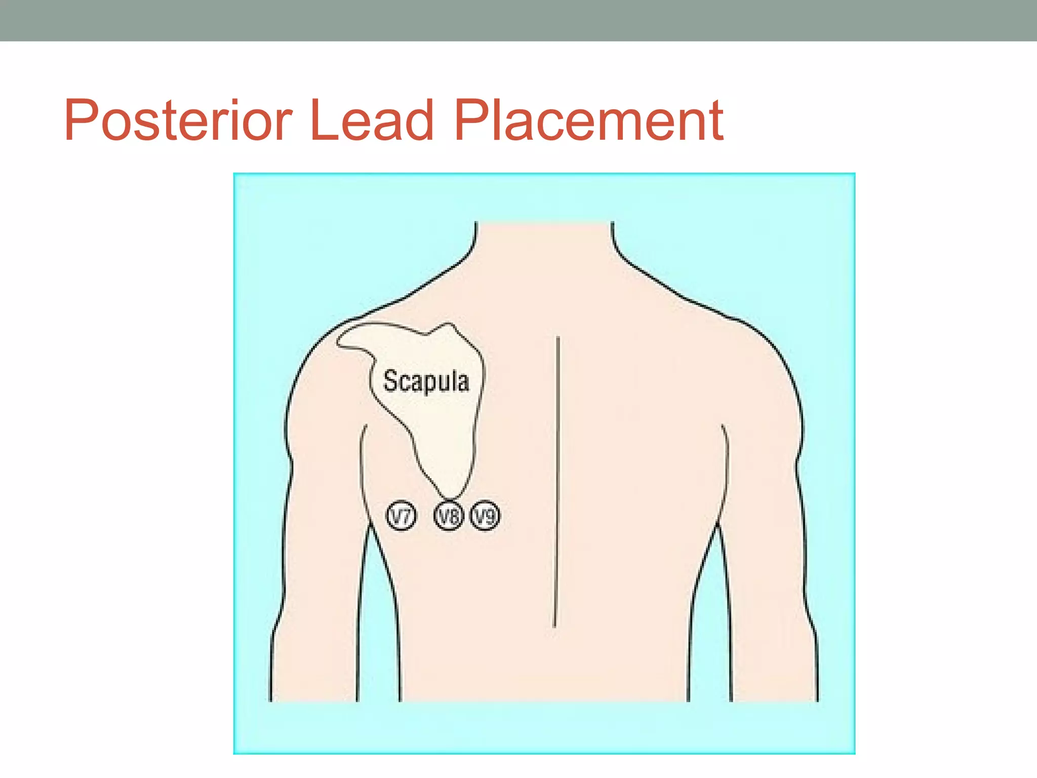 12 lead competency | PPT
