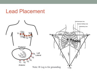 12 lead competency | PPT