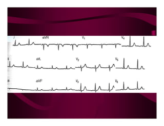 12-lead EKG Interpretation1.pdf
