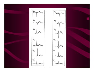 12-lead EKG Interpretation1.pdf