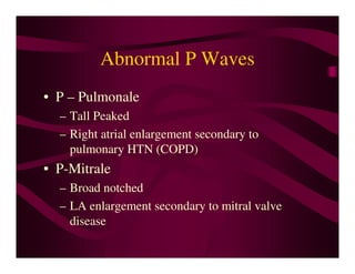 12-lead EKG Interpretation1.pdf