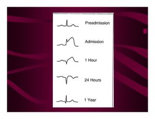 12-lead EKG Interpretation1.pdf