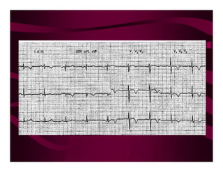 12-lead EKG Interpretation1.pdf