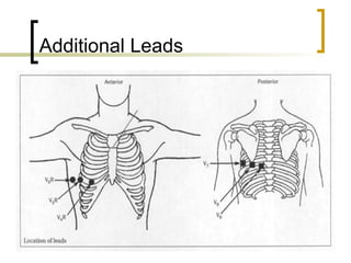 12 lead introduction review of the basics | PPT