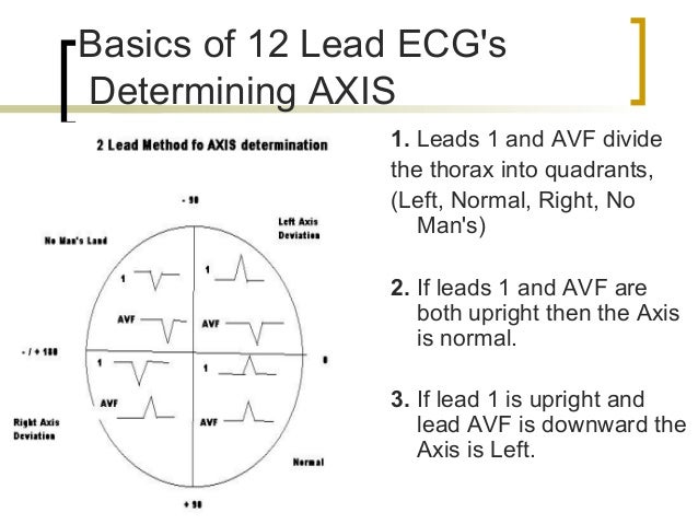 12 lead introduction review of the basics