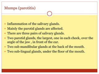12 Mumps (parotitis) gendongan pada anak | PPT | Ear, Nose and Throat ...