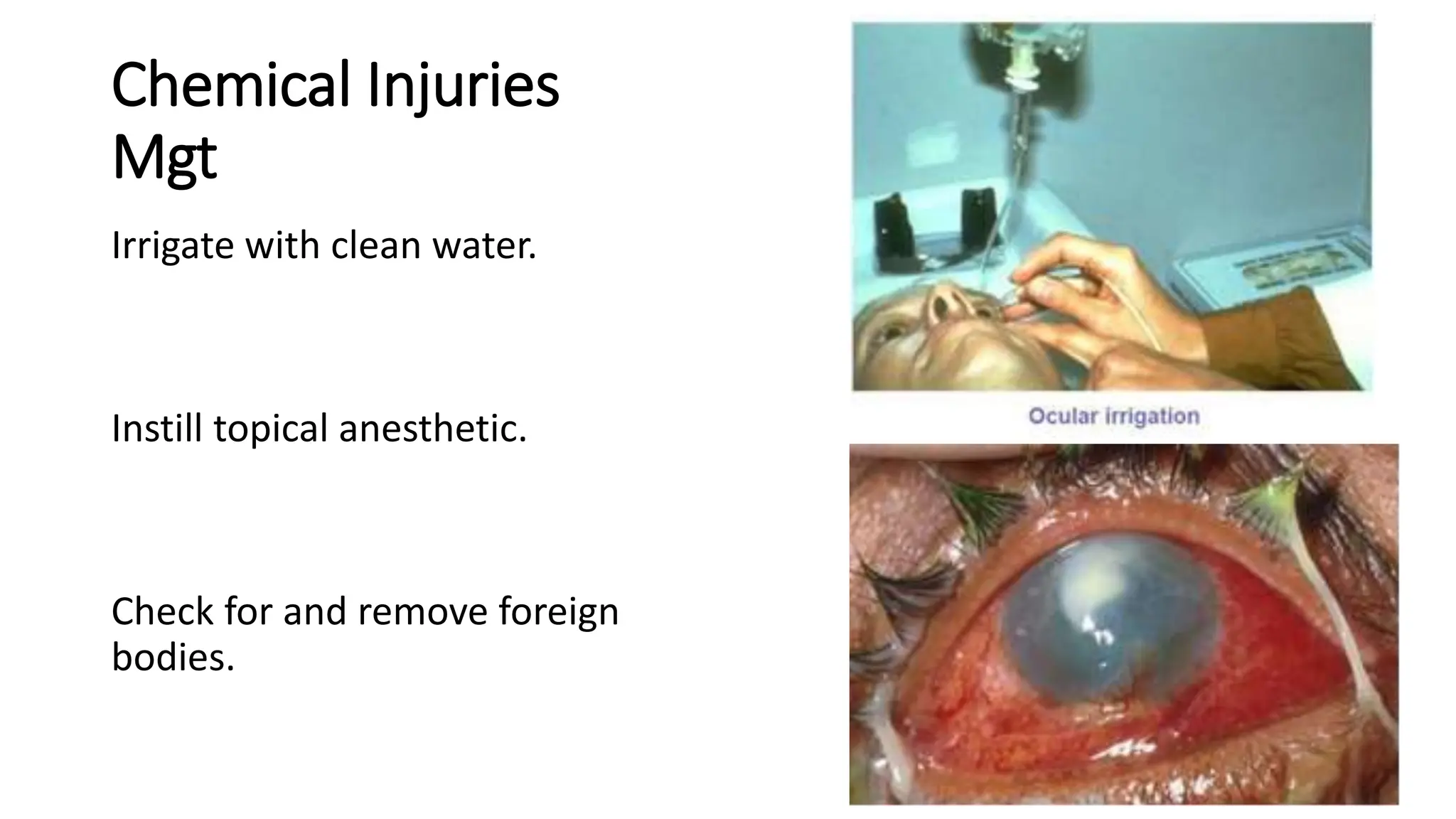 12-Ocular emergencies and common eye disorders.pptx