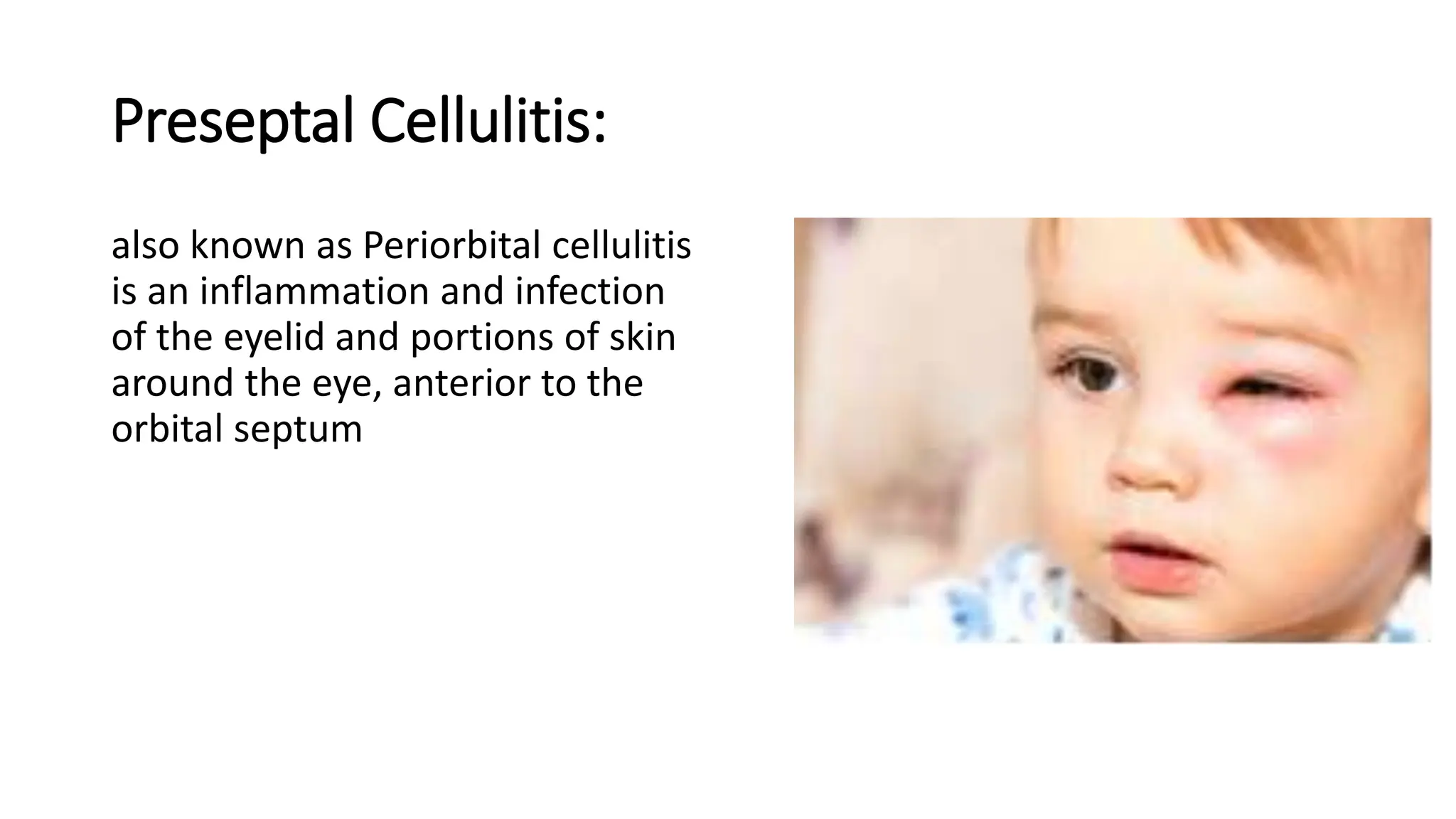 12-Ocular emergencies and common eye disorders.pptx