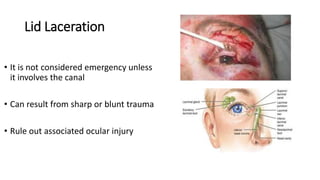 12-Ocular emergencies and common eye disorders.pptx