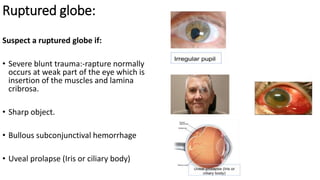 12-Ocular emergencies and common eye disorders.pptx