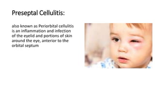 12-Ocular emergencies and common eye disorders.pptx