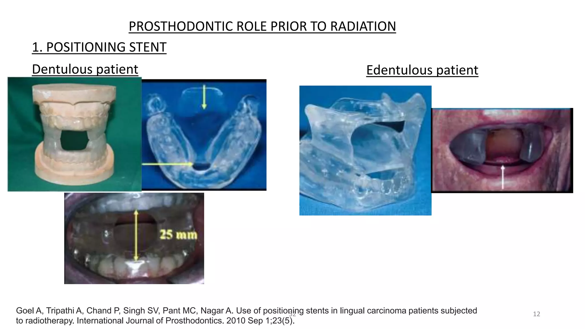 oral and general manifestation of radiated patients - Kelly | PPTX