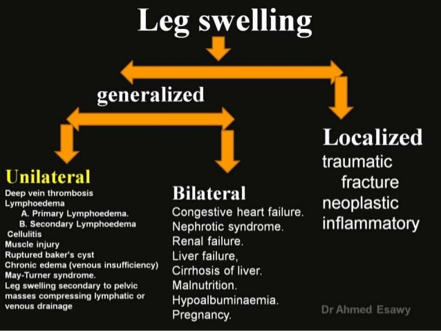12 peripheral venous duplex pitfalls differential diagnosis dvt dr a…