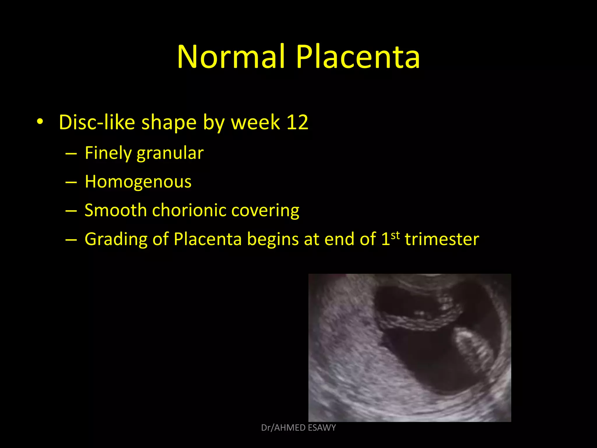 12-placenta imaging Dr Ahmed Esawy | PDF