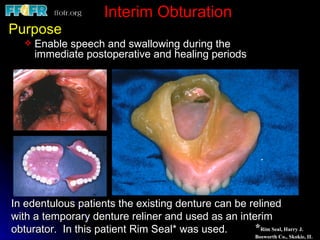 Surgical and Interim Obturation | PPT