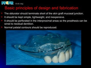 Surgical and Interim Obturation | PPT