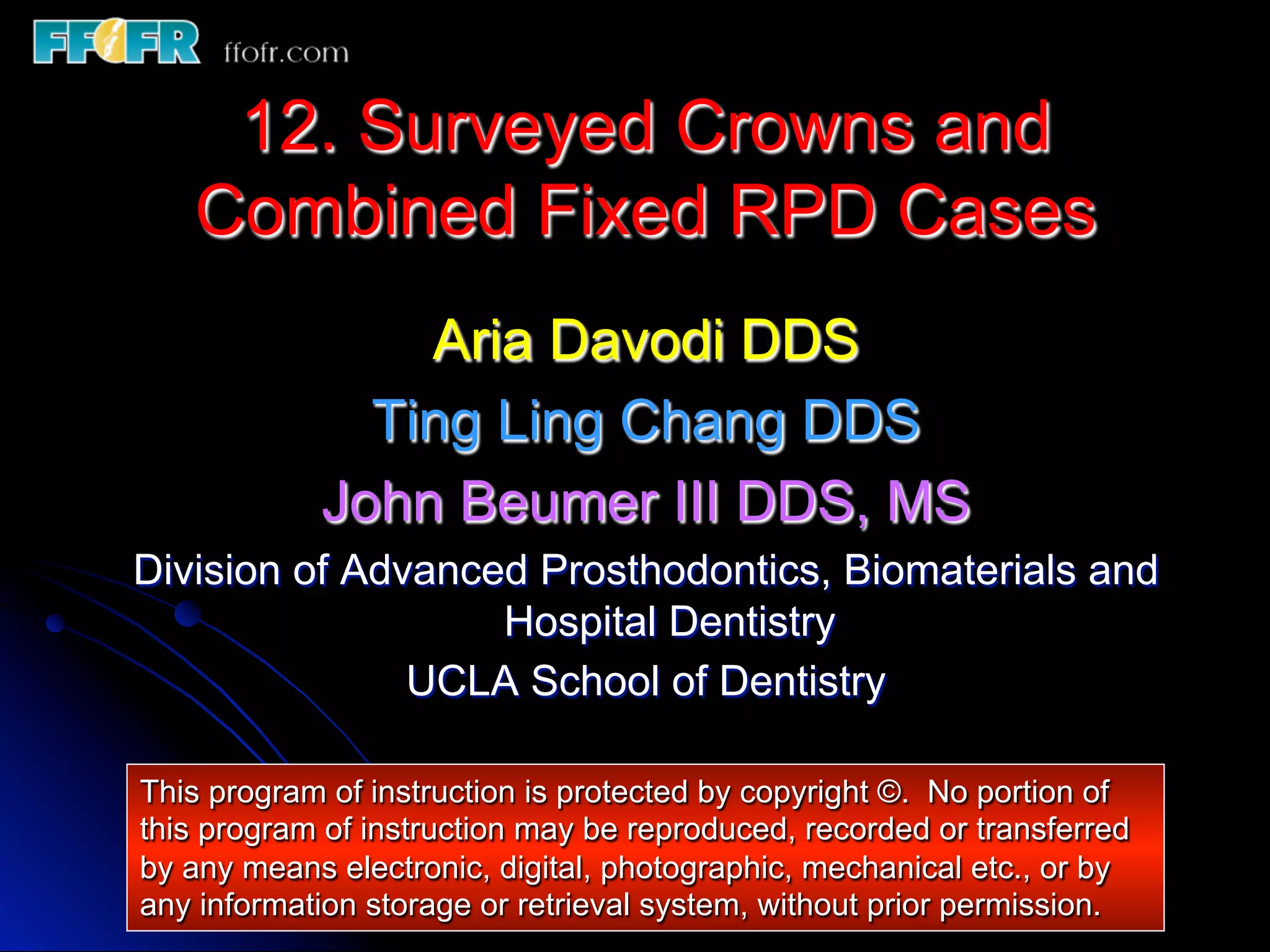 12.surveyed crowns and combined fixed rpd cases | PDF