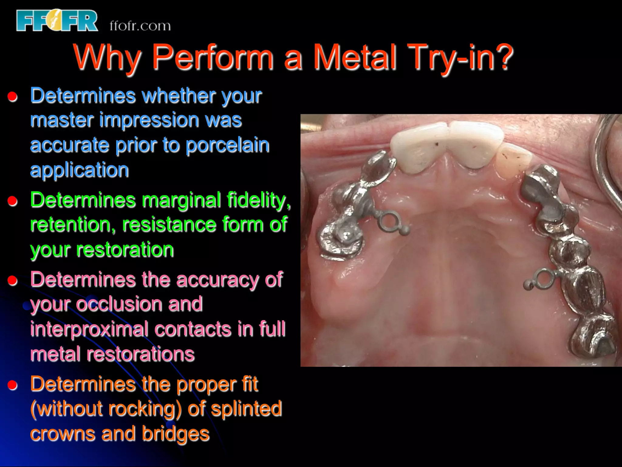 12.surveyed crowns and combined fixed rpd cases | PDF