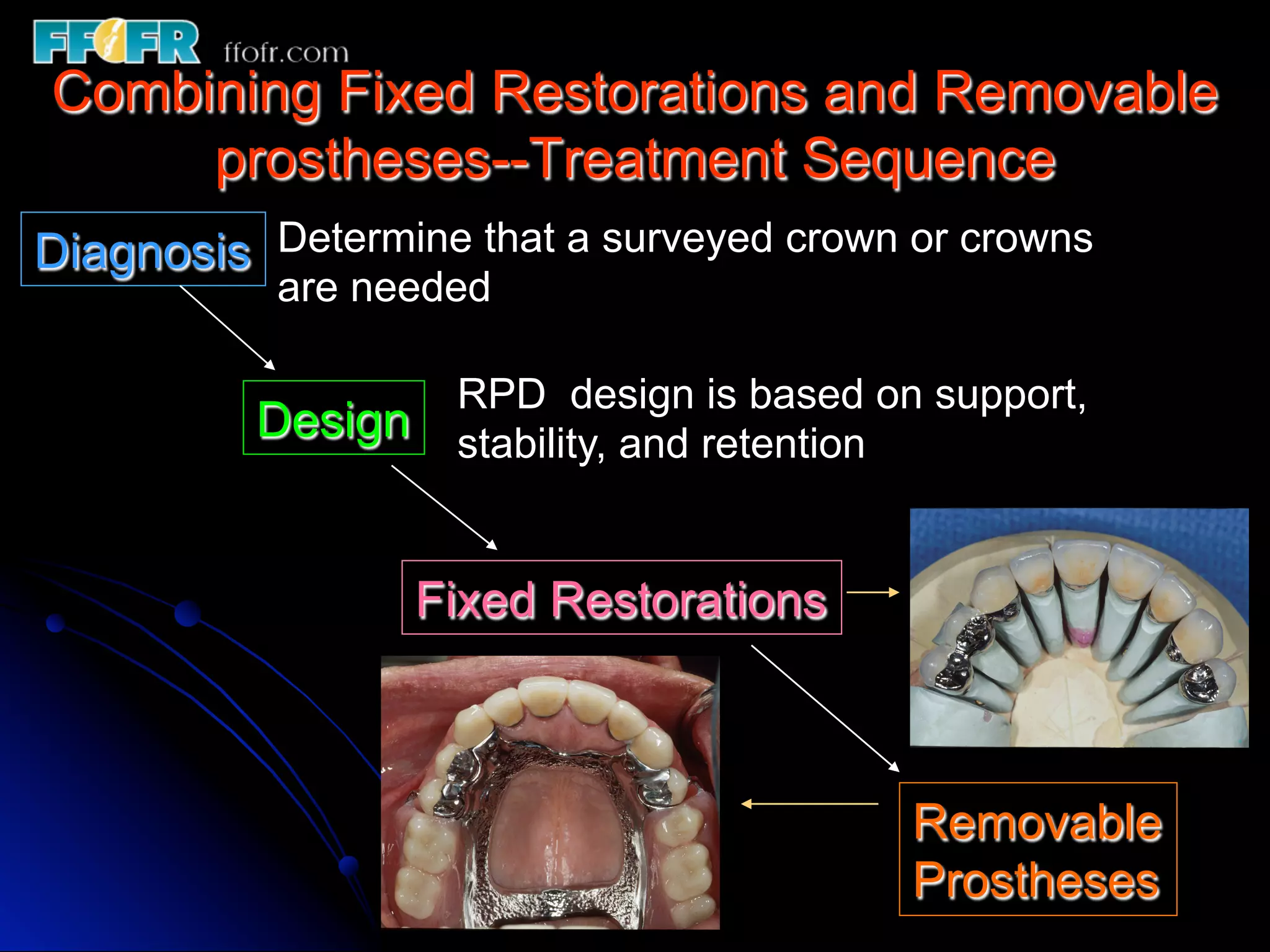 12.surveyed crowns and combined fixed rpd cases | PDF