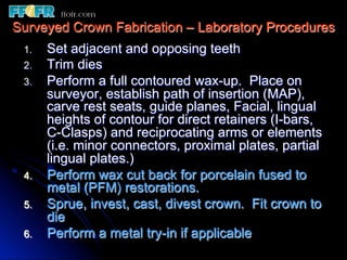 12.surveyed crowns and combined fixed rpd cases | PDF