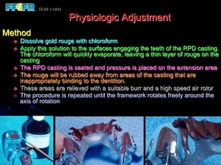 12.surveyed crowns and combined fixed rpd cases | PDF