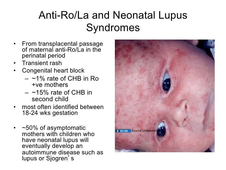 Series | The Last Half