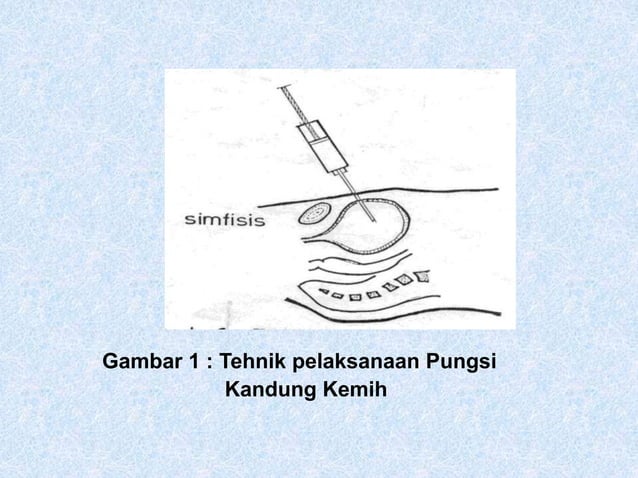 12047606asdasd5-Infeksi-Saluran-Kemih.ppt