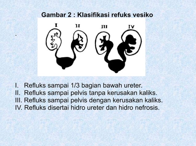 12047606asdasd5-Infeksi-Saluran-Kemih.ppt