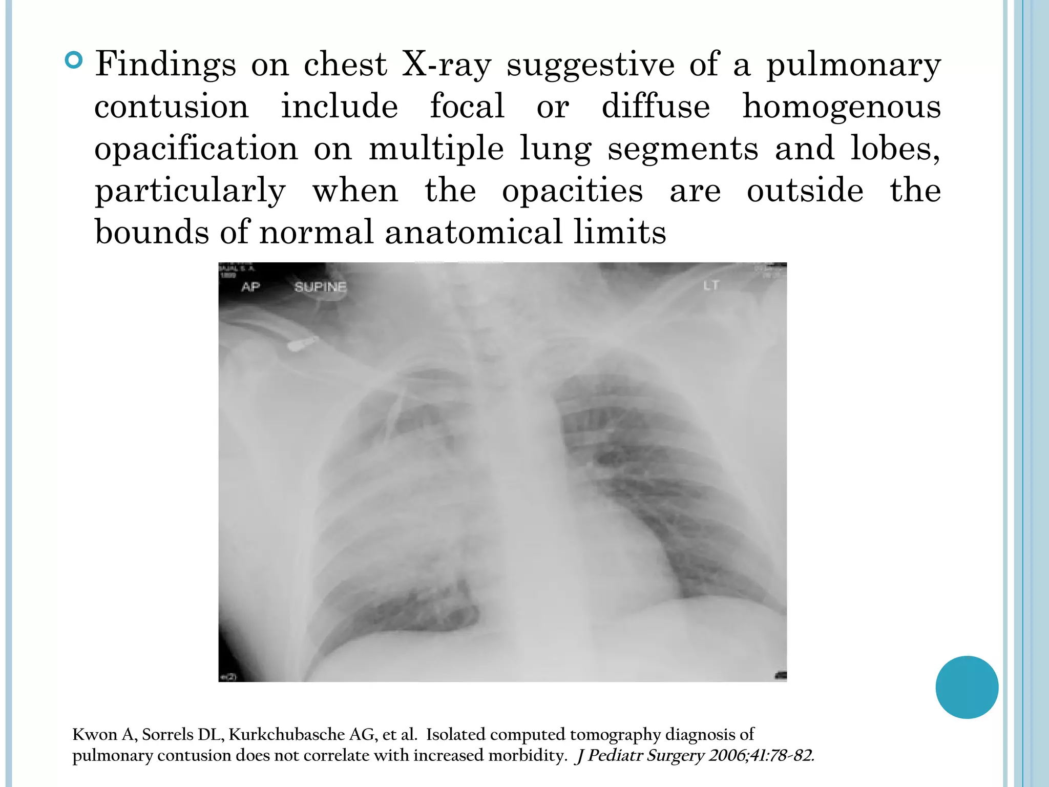 12100053 pulmonary contusion | PPT