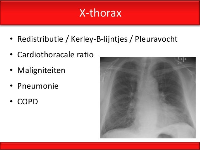 Hartfalen / decompensatio cordis