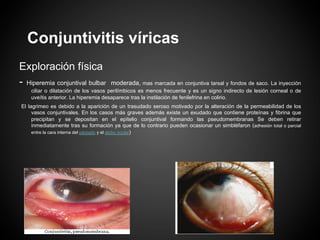 conjuntivitis | PDF
