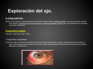conjuntivitis | PDF