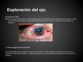 conjuntivitis | PDF
