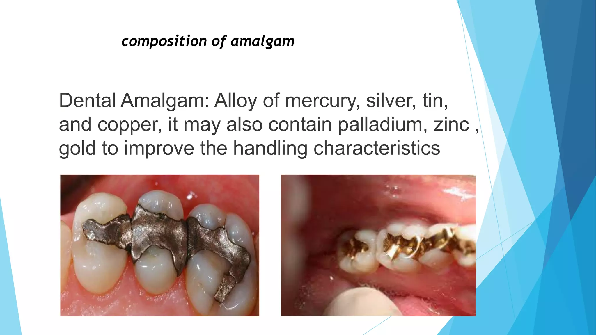 amalgam restoration | PPTX