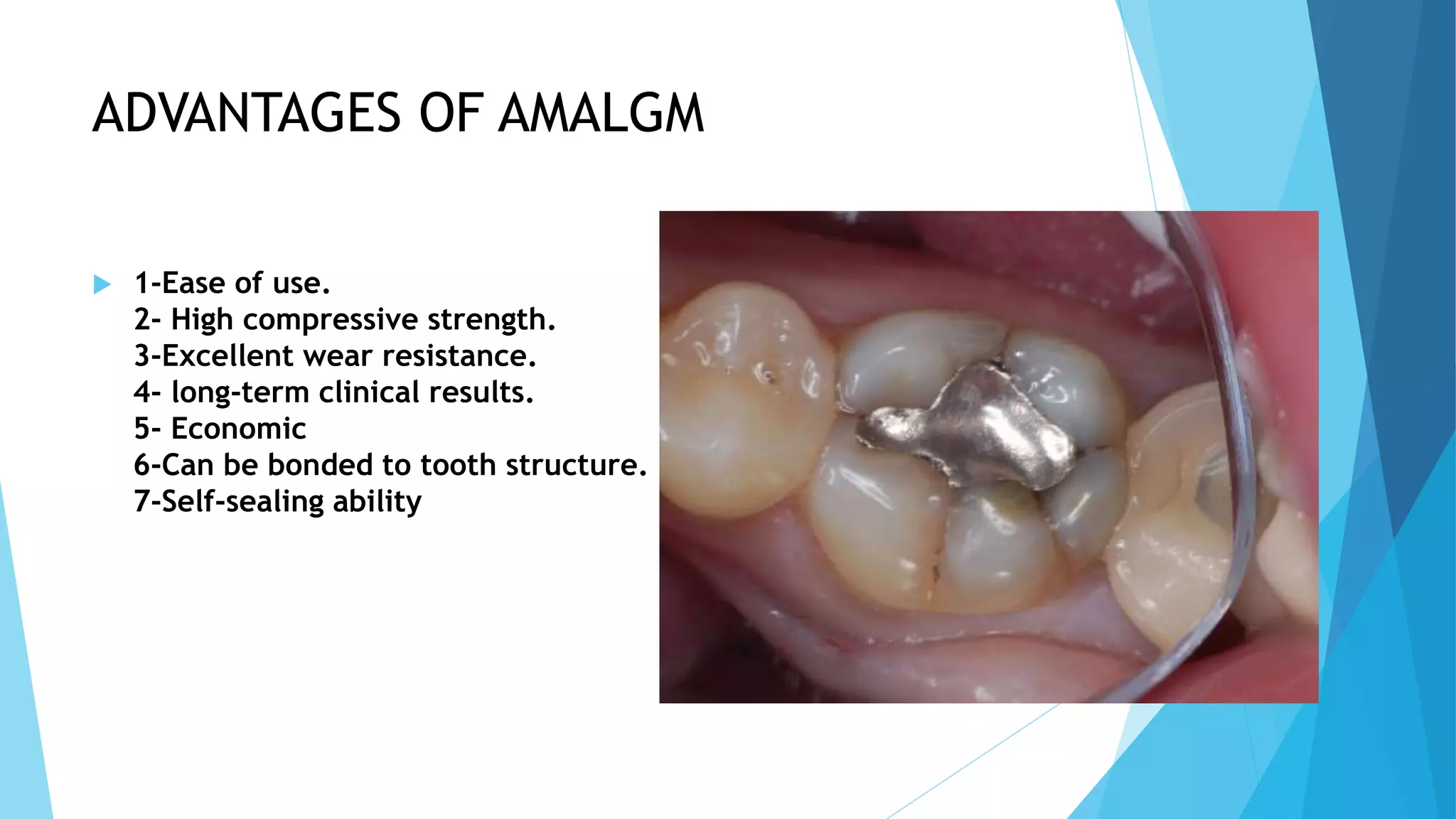 amalgam restoration | PPTX