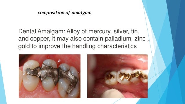 amalgam restoration