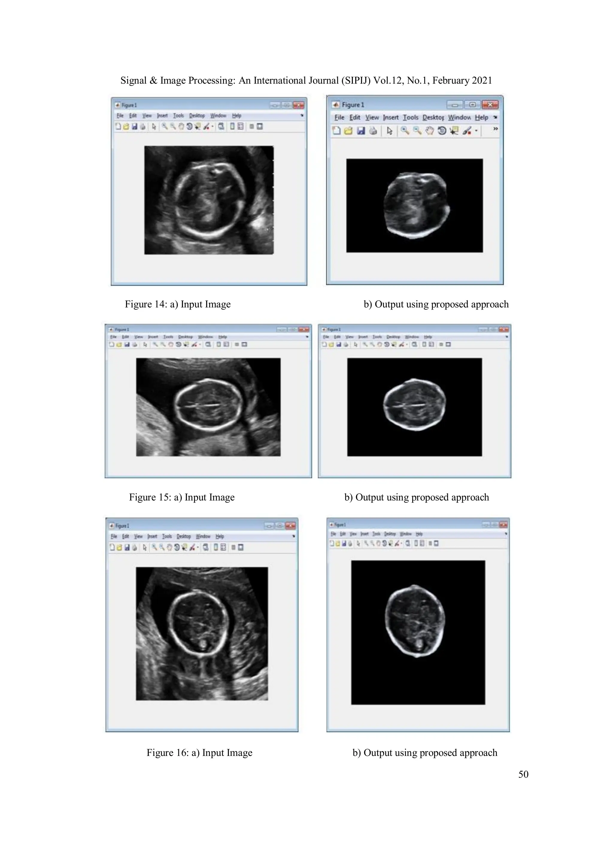 Role of Hybrid Level Set in Fetal Contour Extraction | PDF