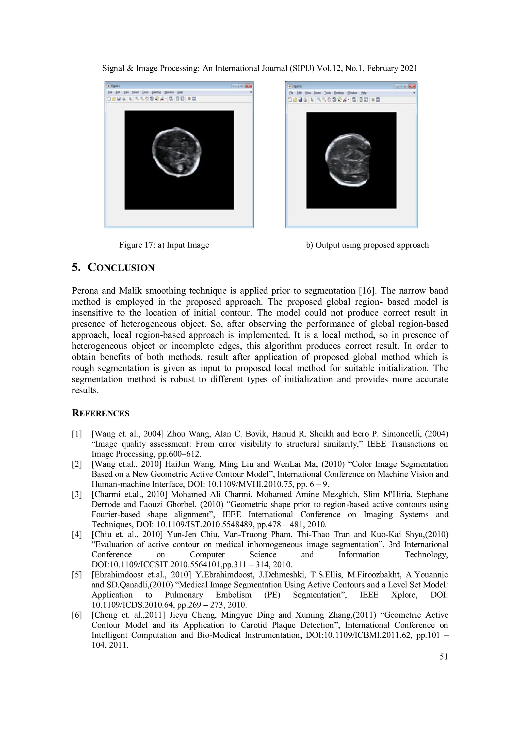Role of Hybrid Level Set in Fetal Contour Extraction | PDF