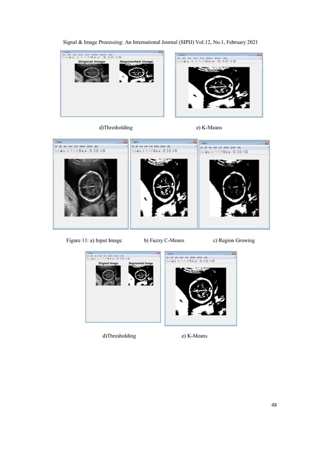 ROLE OF HYBRID LEVEL SET IN FETAL CONTOUR EXTRACTION | PDF