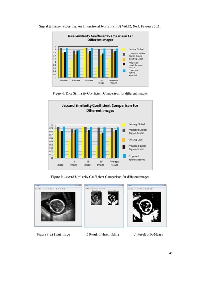 ROLE OF HYBRID LEVEL SET IN FETAL CONTOUR EXTRACTION | PDF