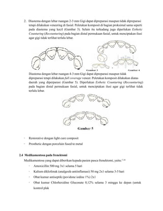 121341358 frenektomi | DOC
