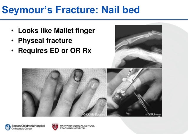 12162015 presentation of hand and wrist injuries