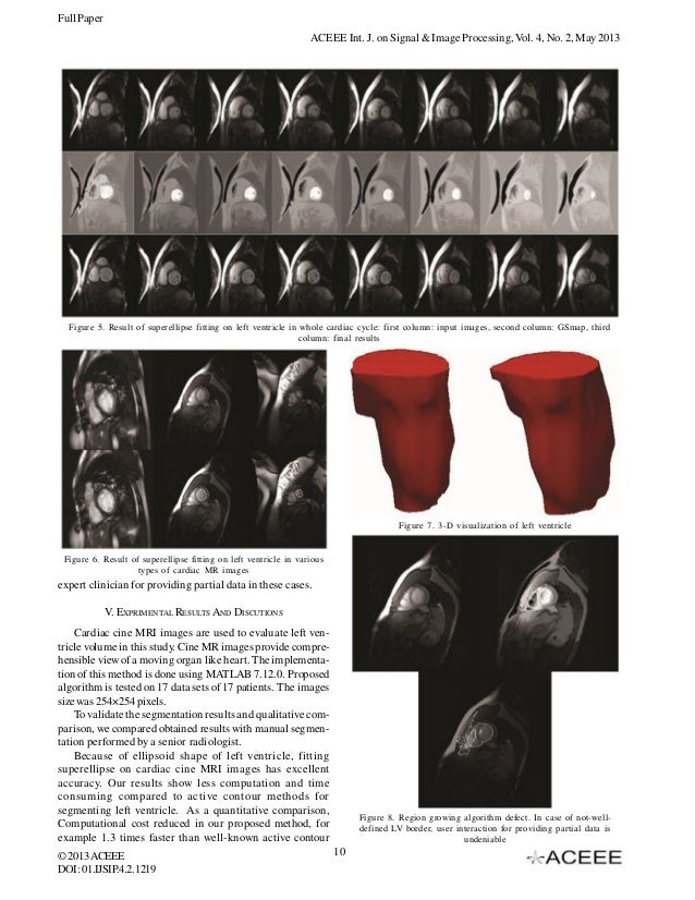 Left Ventricle Volume Measurement On Short Axis Mri I - vrogue.co