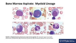 regulation of hematopoesis and leukemia1 | PDF