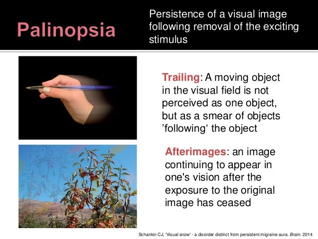 Visual trails : r/lexapro