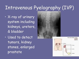 121 Week 5 Chapter 8 Urinary System Recent | PPT | Cancer | Diseases ...