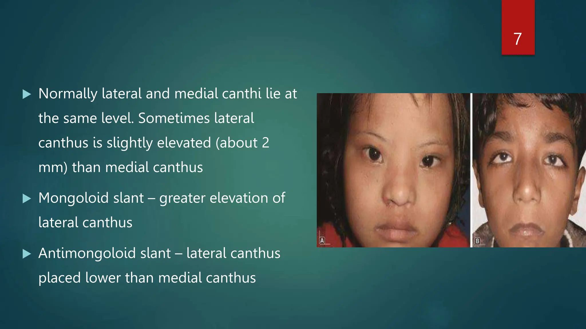 anatomy of eyelid ophthalmology presentation | PPTX