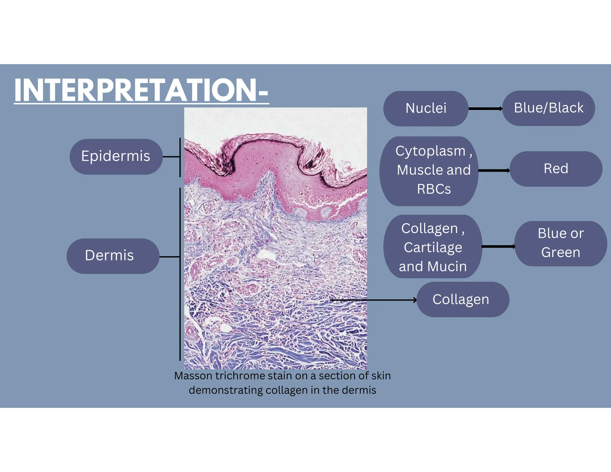 MASSON TRICHROME STAINS AND THEIR INTERPRETITIONS | PDF